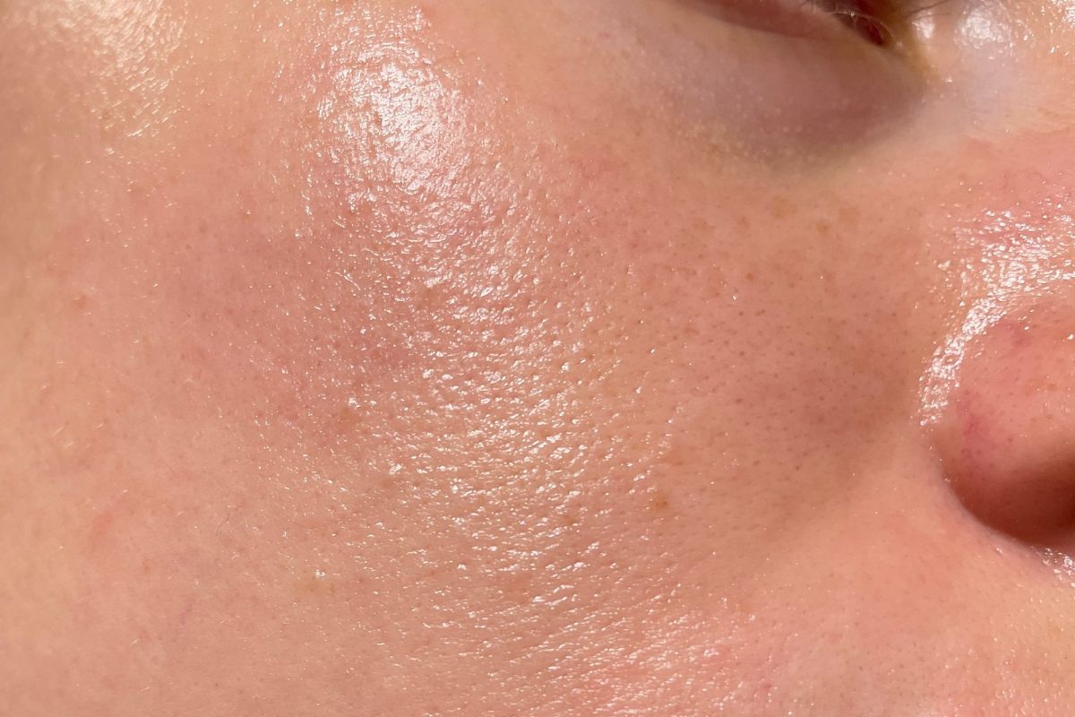 Affiliated Dermatology Arizona s Top Dermatologists Affiliated Dermatology Arizona s Top Dermatologists